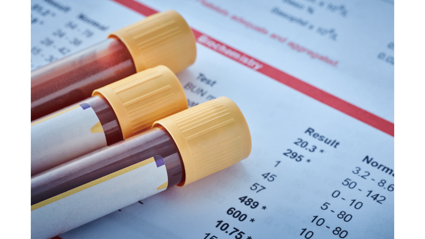 How Long Does Cocaine Stay in Your System?